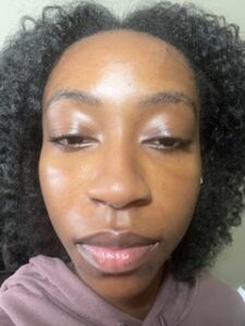 The 3D MIRACL: Trying Out The Famous "Cold" Fractional Laser