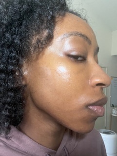 The 3D MIRACL: Trying Out The Famous "Cold" Fractional Laser